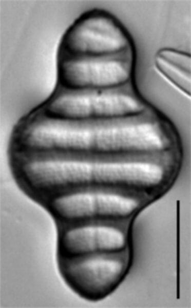 Images of Tetracyclus glans | Species - Diatoms of North America