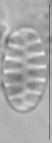 Staurosirella pinnata | Species - Diatoms of North America