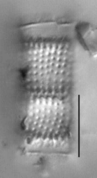 Aulacoseira lirata | Species - Diatoms of North America